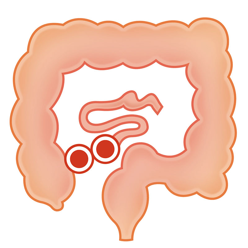 Journal Articles - Ileostomy & Internal Pouch Association